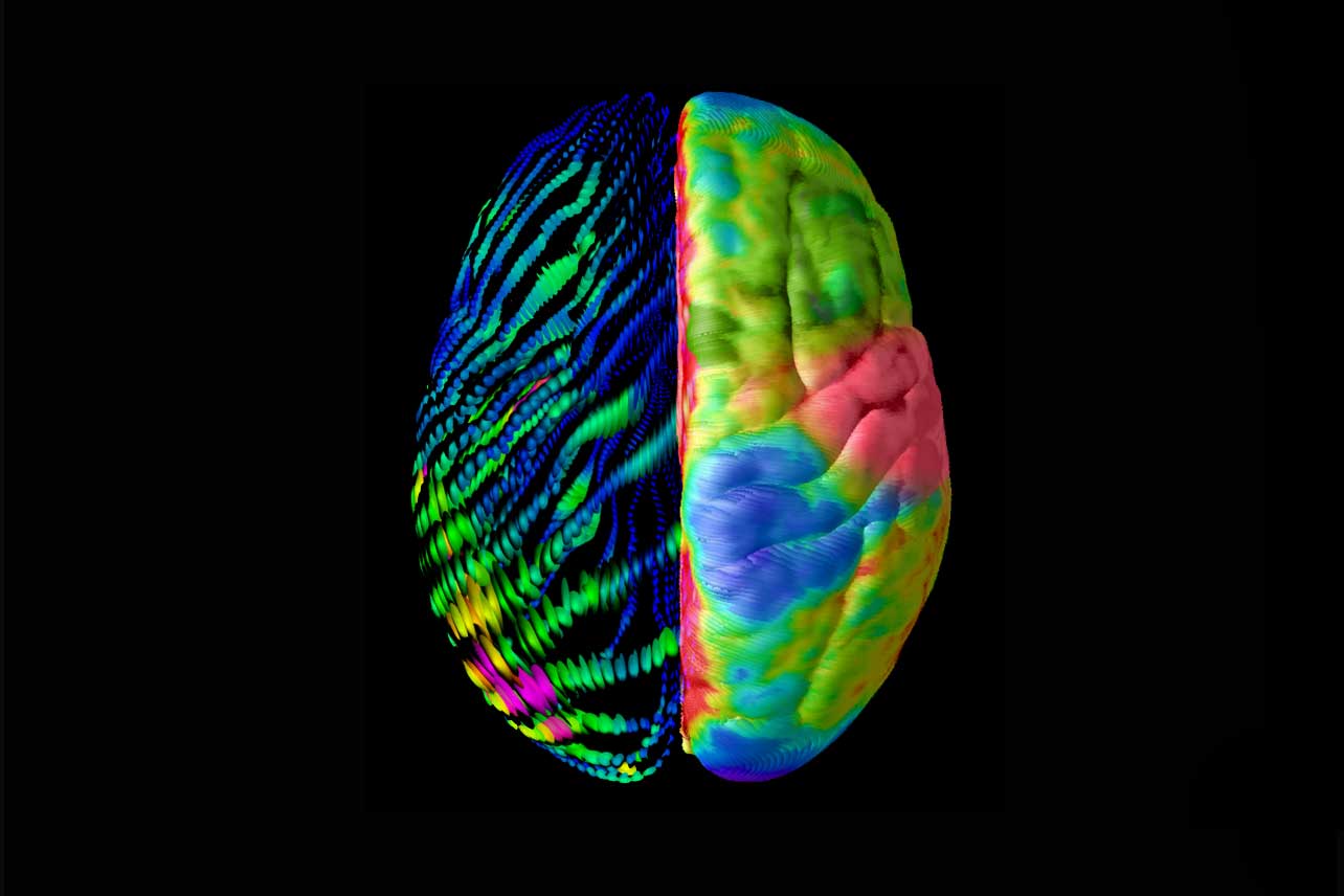 $21.7 million spurs USC research on how epilepsy develops - USC Today