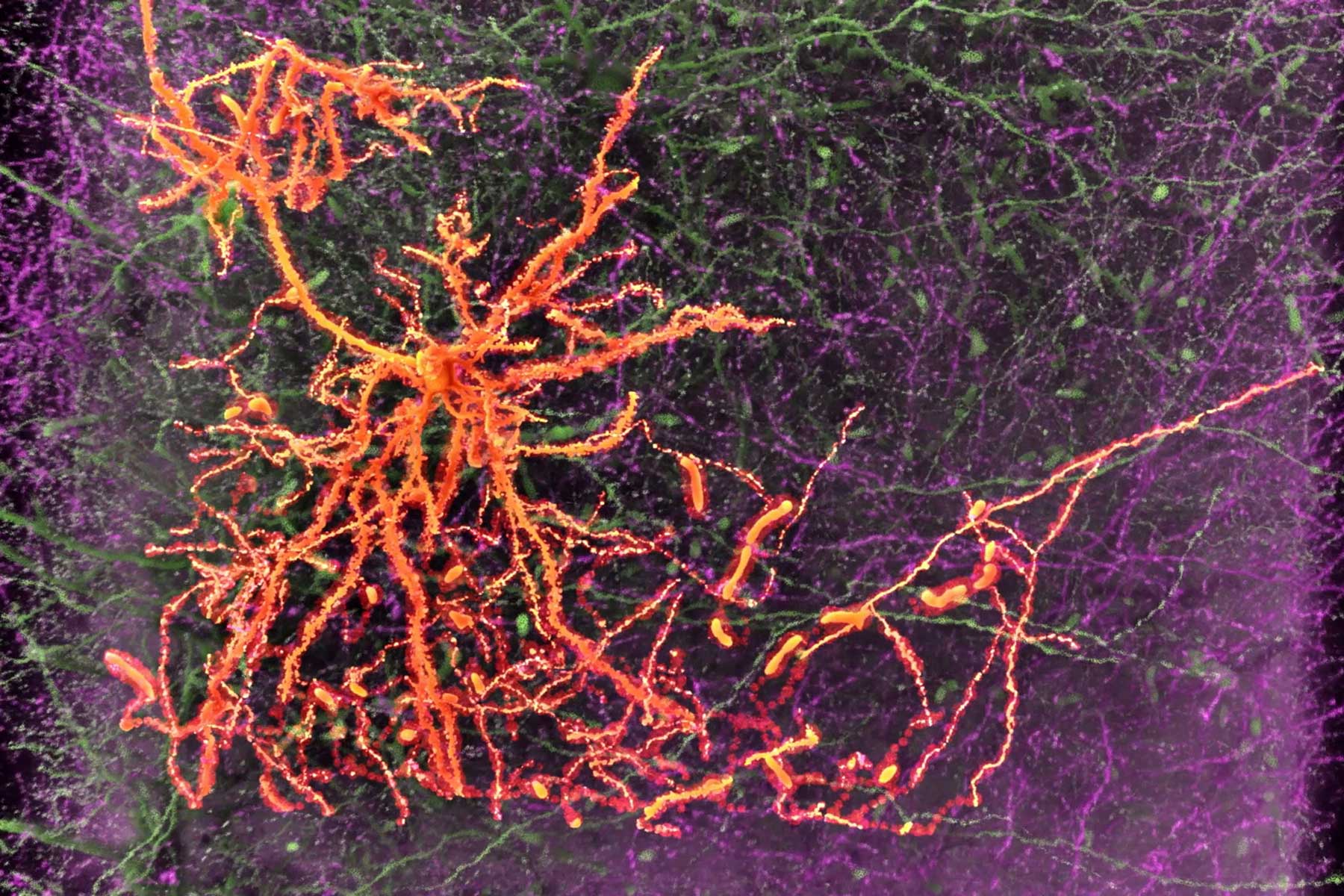 Brain cell study at USC gets $19 million National Institutes of Health ...