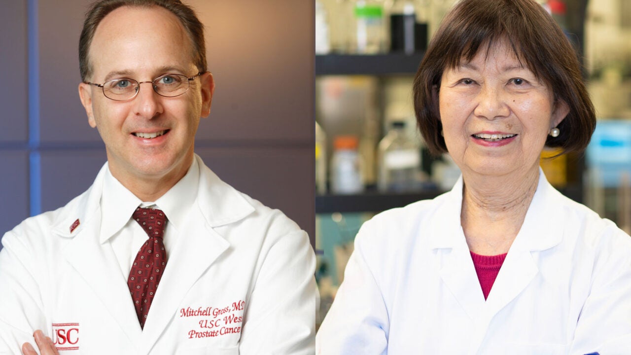 Antidepressant shows promise in treating recurrent prostate cancer